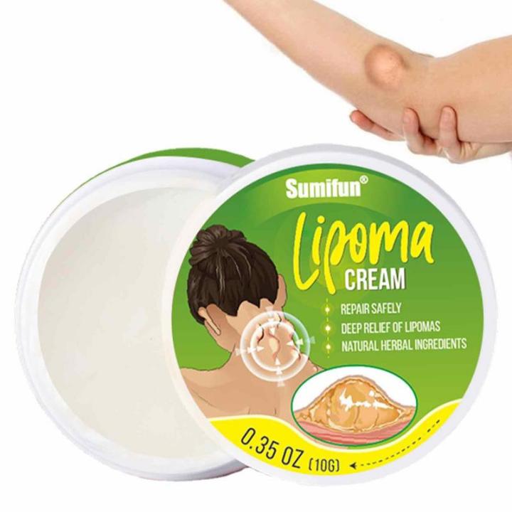 Lipoma Removal Cream 10G Lipoma Elimination Cream Herbal Lymph Care ...