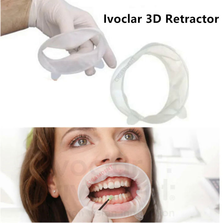 OptraGate 3D ทันตกรรมปากเปิด Lip Cheek Retractor O รูปร่างปกติขนาดเล็ก ...