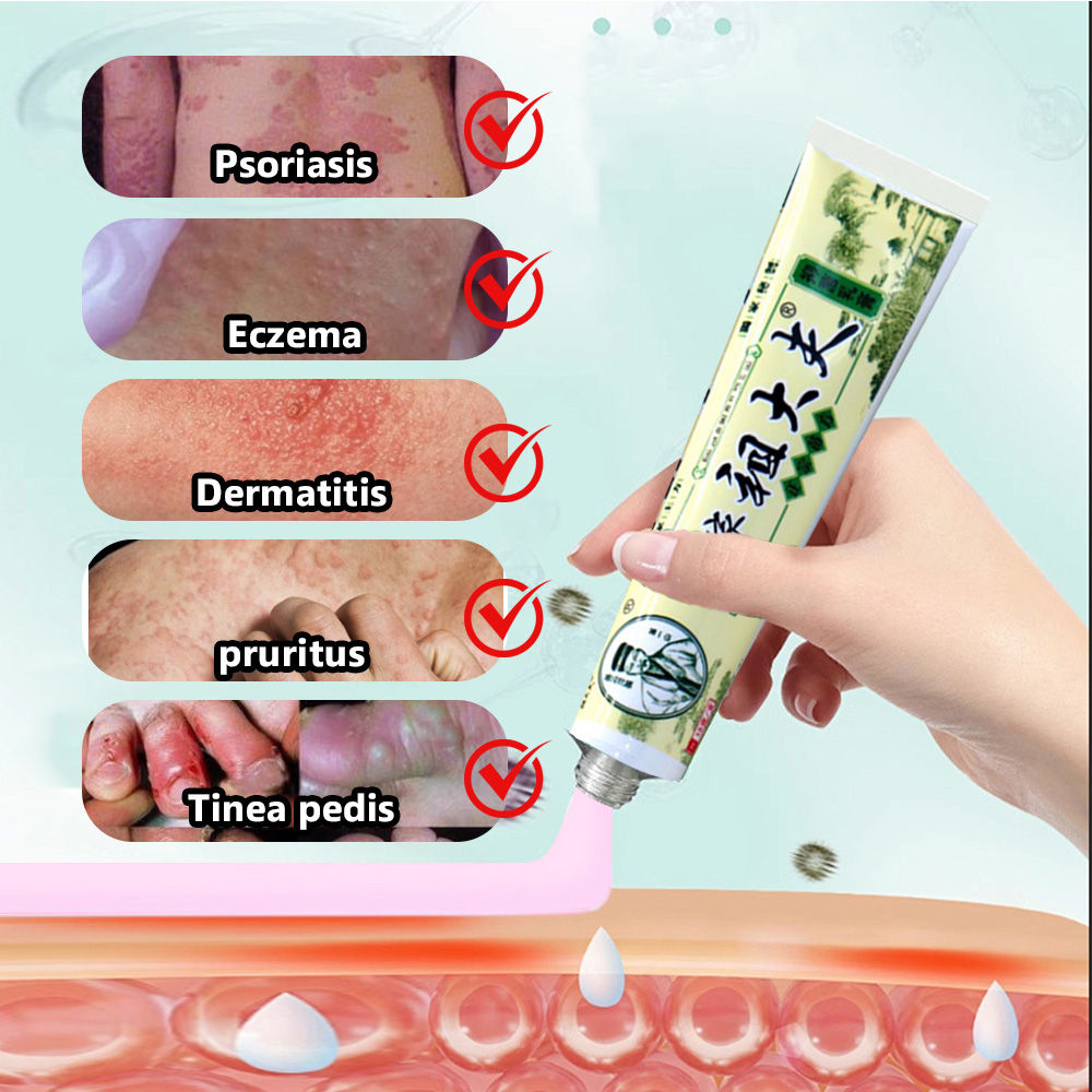 3/5PCS Miaojia zudaifu Cream*3pcs Skin Herbal Psoriasis Dermatitis ...