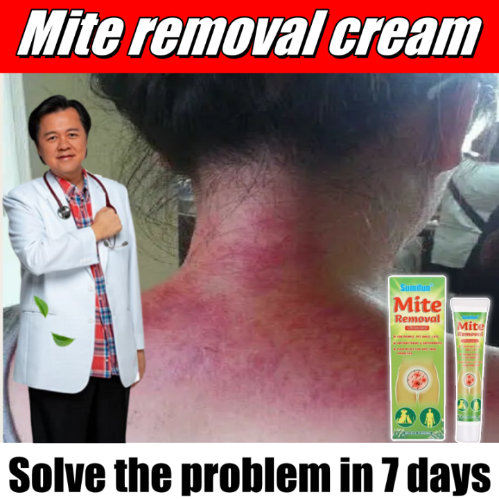 SUMIFUN skin anti-itch cream mite removal cream antibacterial anti-itch ...