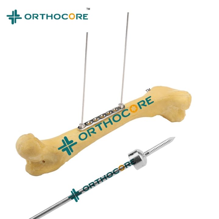 Temporary Reduction-Plate Holding Threaded Pins CNC Manufacturing ...