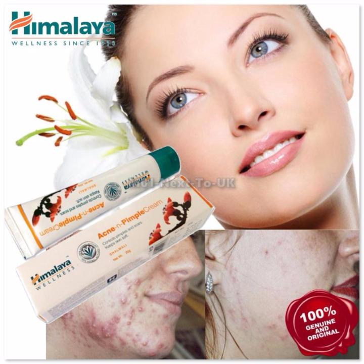 HIMALAYA ACNE PIMPLE CREAM 20g | Lazada.co.th